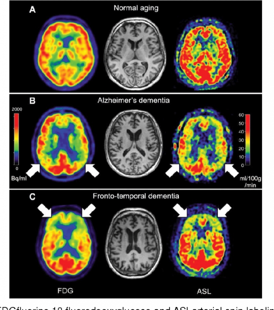 Your Brain Injury Attorney in New York | Frekhtman & Associates
