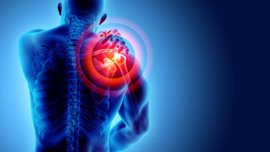 How To Obtain Shoulder Dislocation Treatment After a Vehicle Accident ...